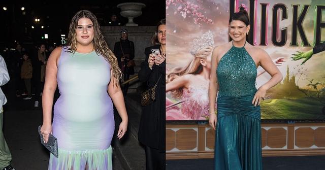 Did Remi Bader Gets Weight Loss Surgery? All About Her Transformation