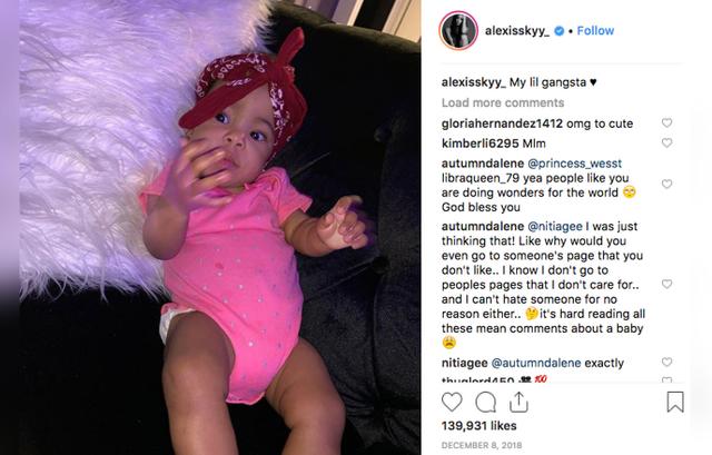 Alexis Skyy’s Baby Alaiya Undergoes Brain Surgery