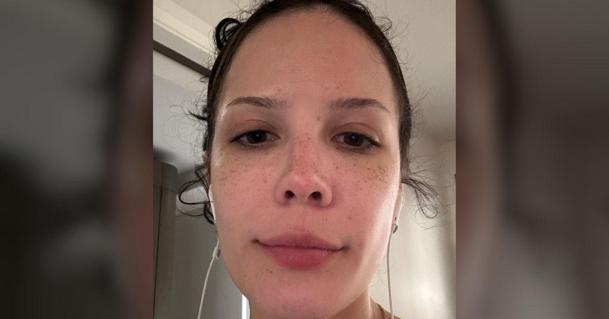 Halsey Reveals She's Been Undergoing Chemotherapy For Rare Disorder