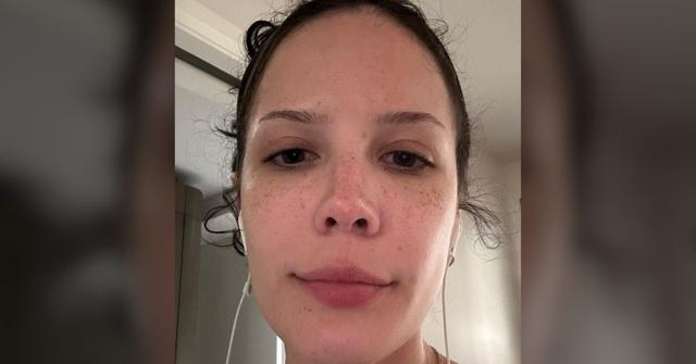 Halsey Reveals She's Been Undergoing Chemotherapy For Rare Disorder