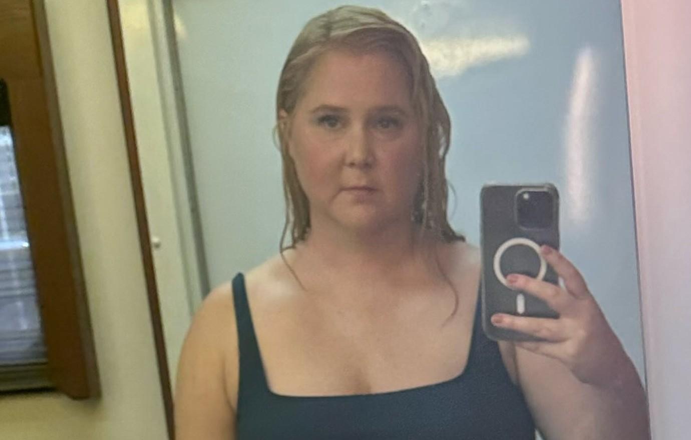 Amy Schumer Fans Praise Her Bare-Faced Selfie Amid Health Woes