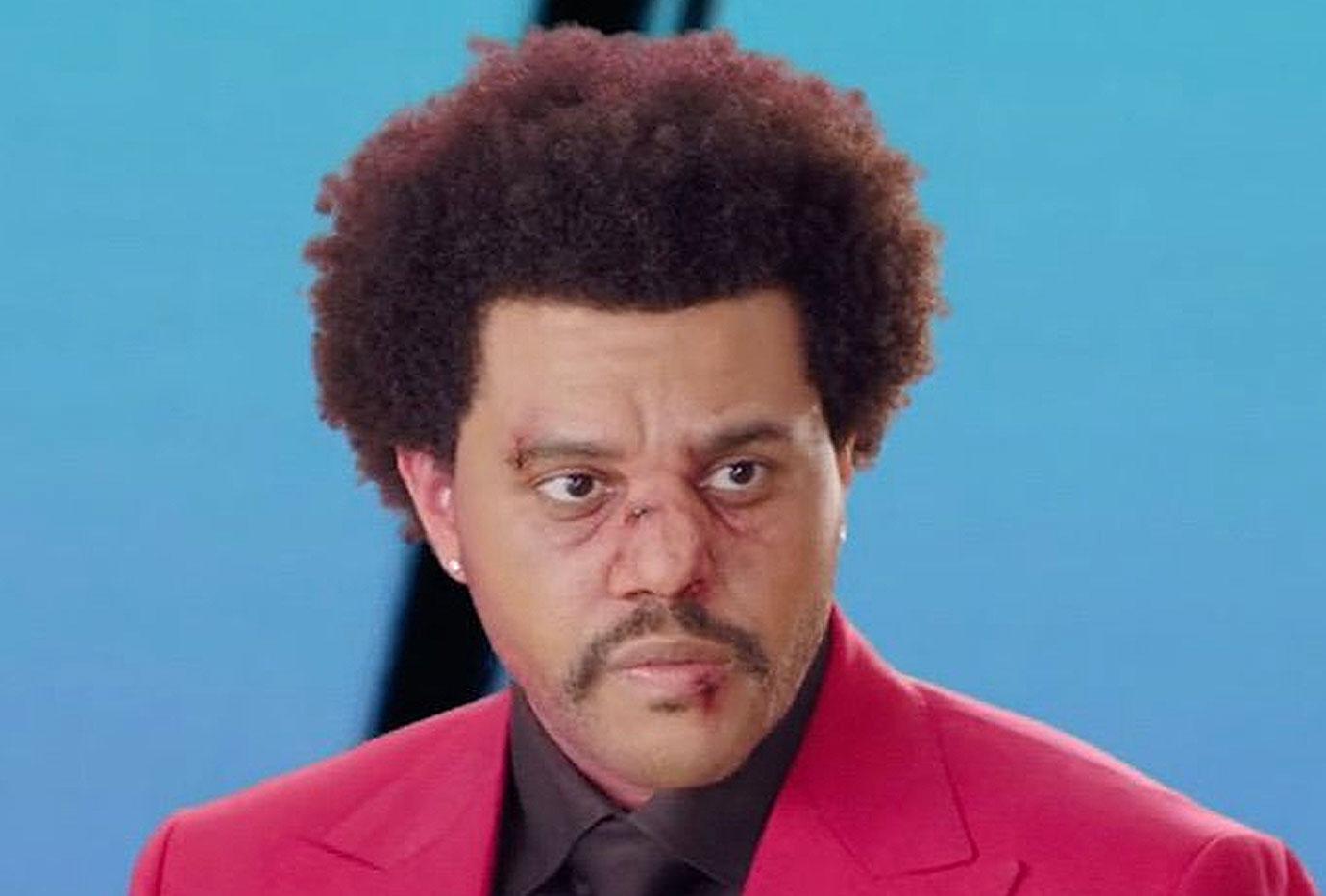 The Weeknd's Face Transformation: See Before And After Photos From His ...