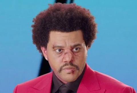 The Weeknd's Face Transformation: See Before And After Photos From His ...
