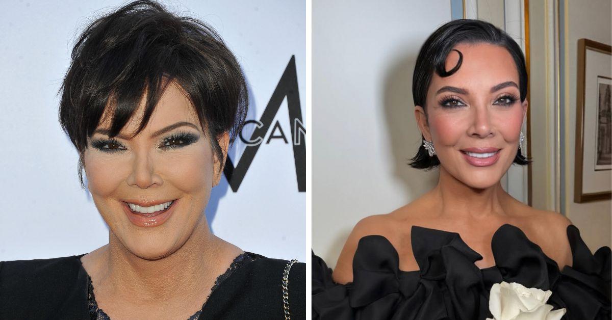 Kris Jenner Spills Details On Facelift & Reveals Who Came To Surgery