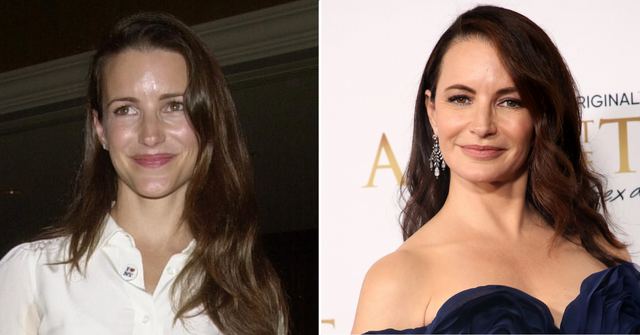 All The Celebs Who Took Face Fillers Too Far, Photos