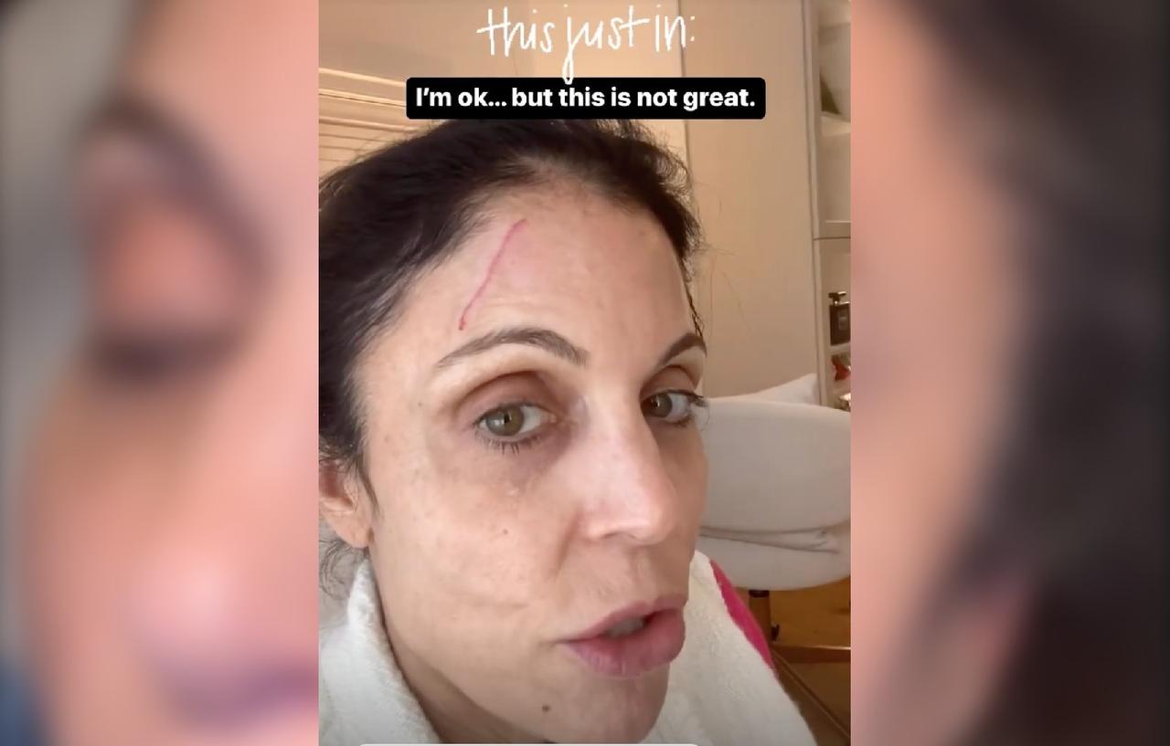 Bethenny Frankel Sustains Facial Injury From Clothing Rack
