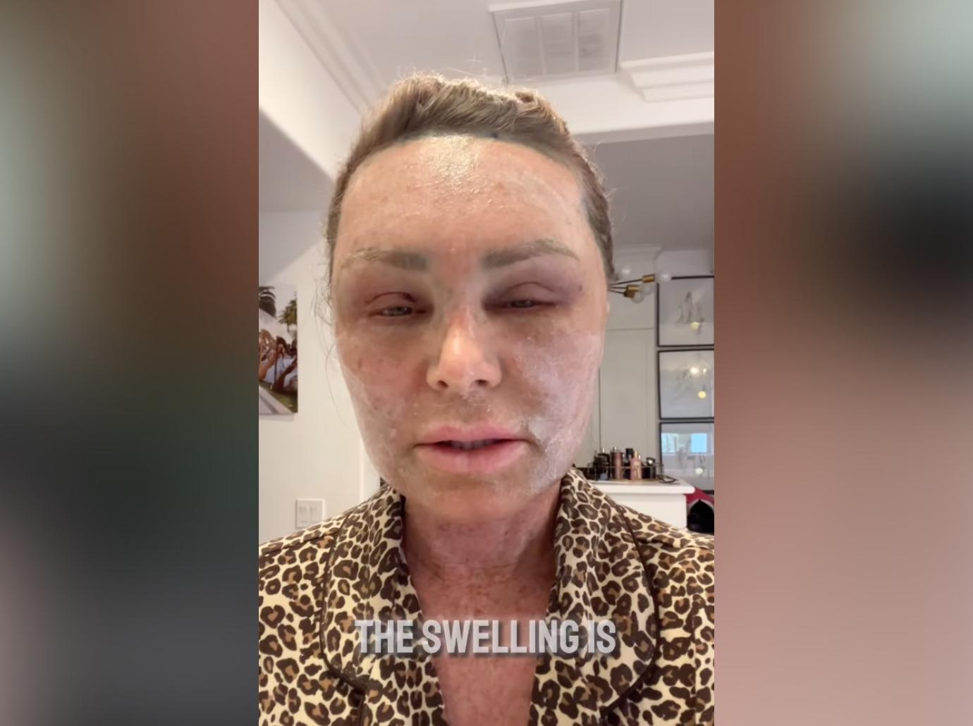 Tamra Judge's Mom Disses Her Face After Plastic Surgery: Photos