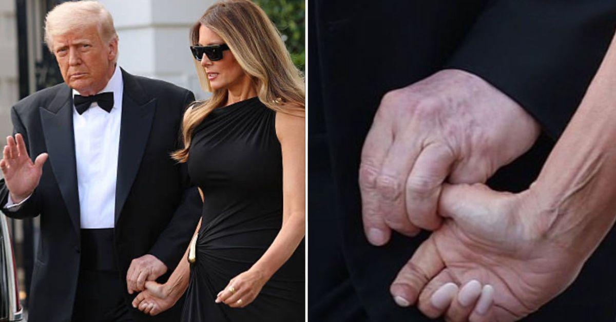 Donald Trump Awkwardly Holds Melania's Hand By Just Her Thumb