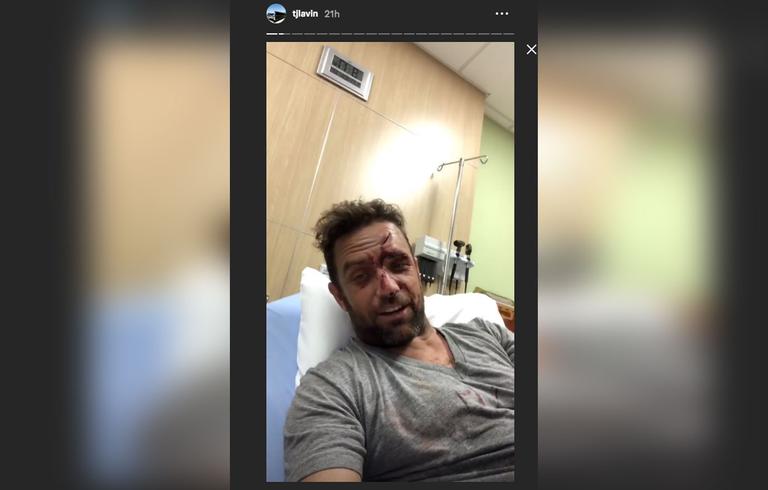 'The Challenge' Host TJ Lavin Seriously Injured in BMX Accident in Vegas