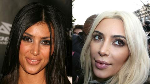 Kim Kardashian Before And After: Inside Her Secret Surgery Transformation