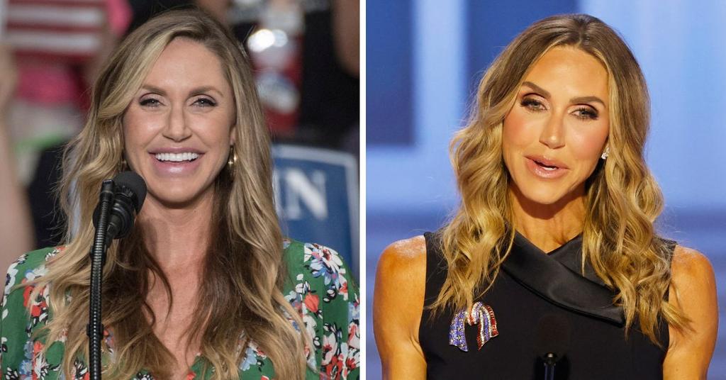 Laura Loomer, Kimberly Guilfoyle's Dramatic Transformations: Photos