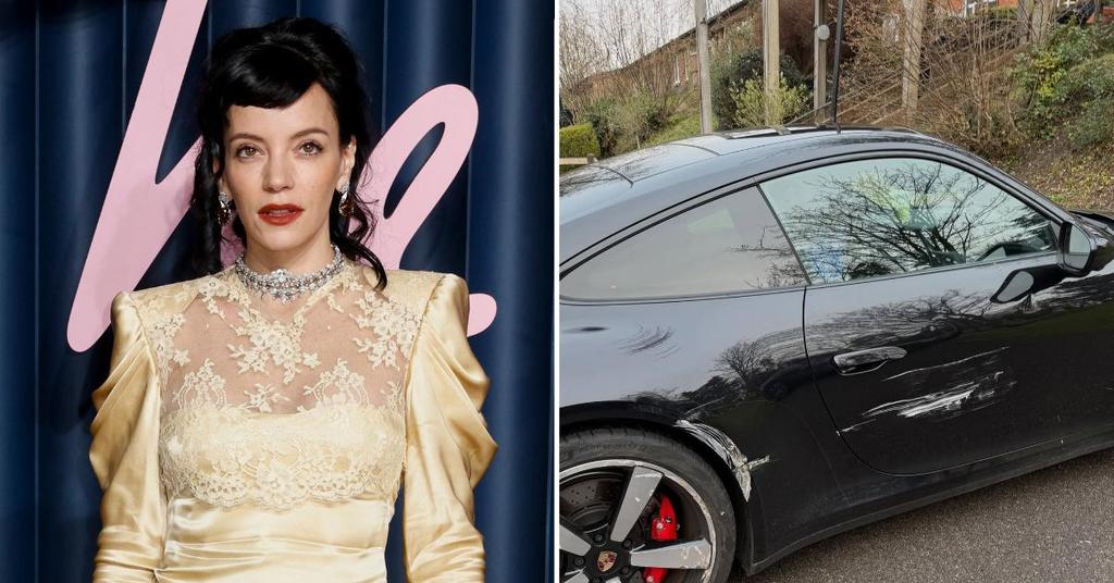 Lily Allen Is ‘Happy to Be Alive’ After Truck Ran Her ‘Off The Road’