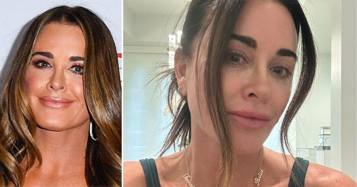 Kyle Richards Praised For Sharing 'Gorgeous' Makeup-Free Selfie