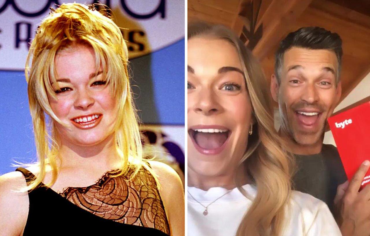 Celeb Byte Before & After Teeth Transformations — Shop Byte Products Now