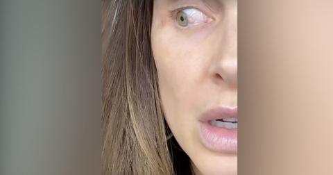 Lala Kent Using 'Chemotherapy Eye Drops' After Noticing 'Discoloration'