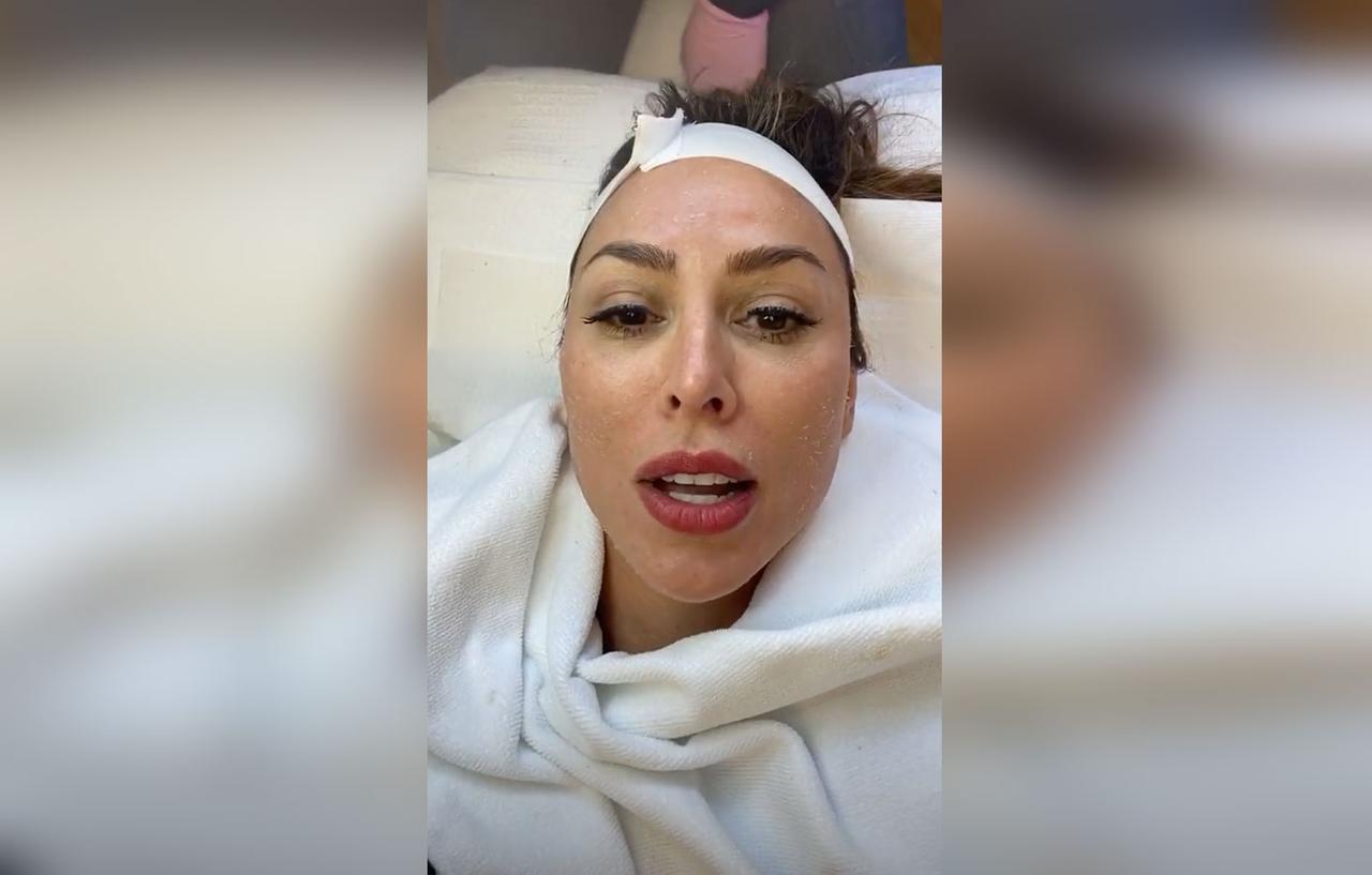 Kelly Dodd Shows Off Results Of Chemical Peel & 'Mini Facelift'