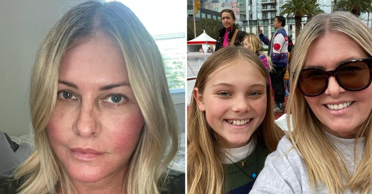 'Baywatch' Star Nicole Eggert Diagnosed With Stage 2 Cancer