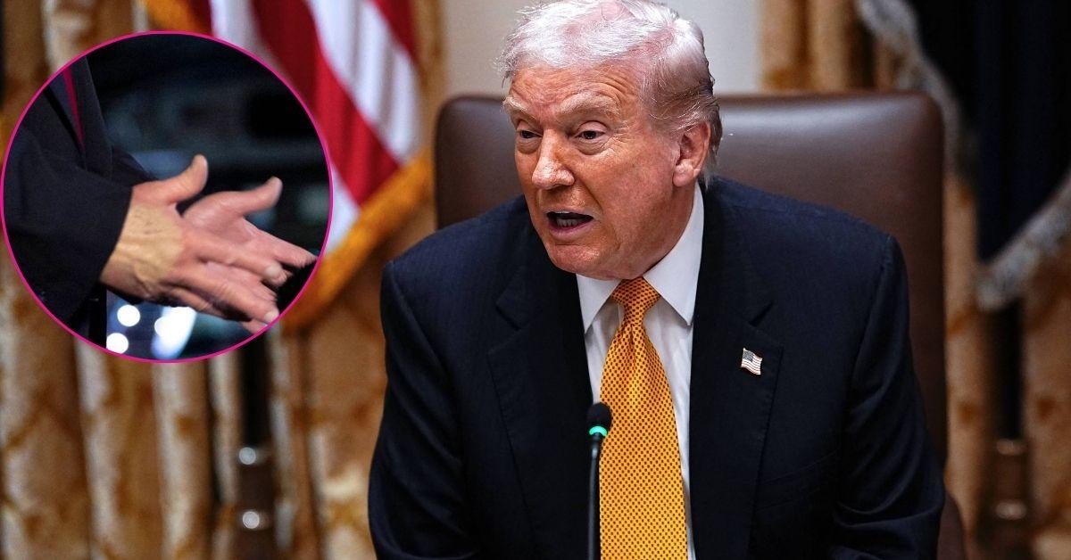 Donald Trump Wears Makeup On Bruised Hand At NFL Game: Photos