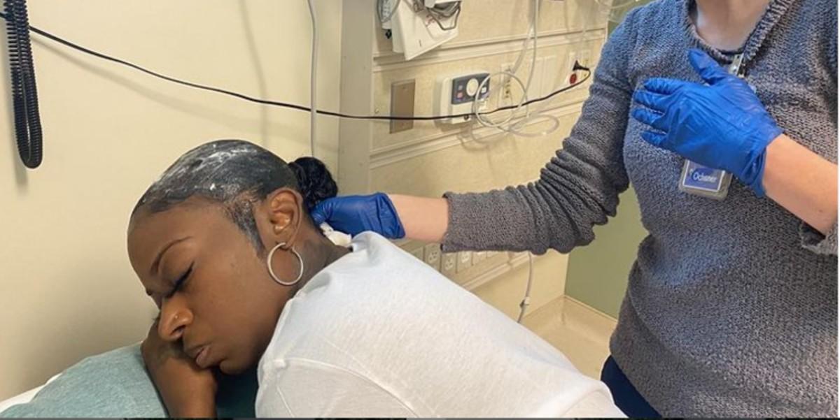 Gorilla Glue Girl Has Surgery To Remove Adhesive From Scalp