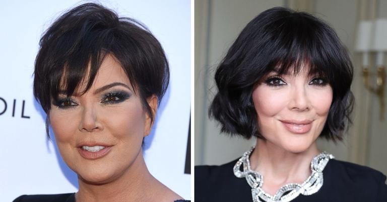 Kris Jenner Spills Details On Facelift & Reveals Who Came To Surgery