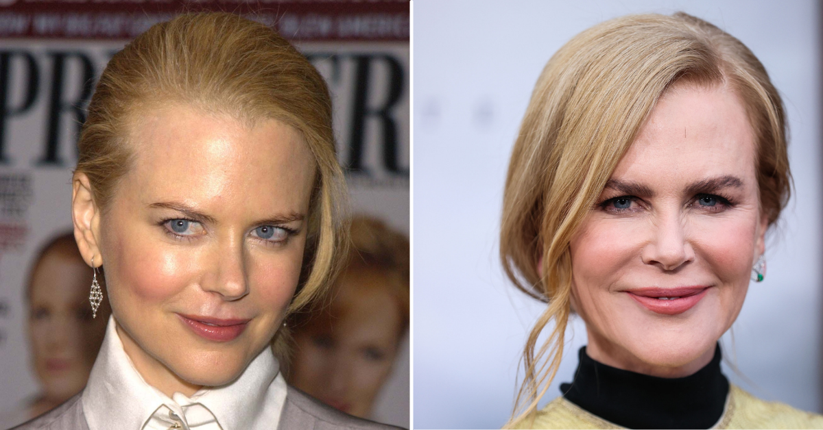 All The Celebs Who Took Face Fillers Too Far, Photos