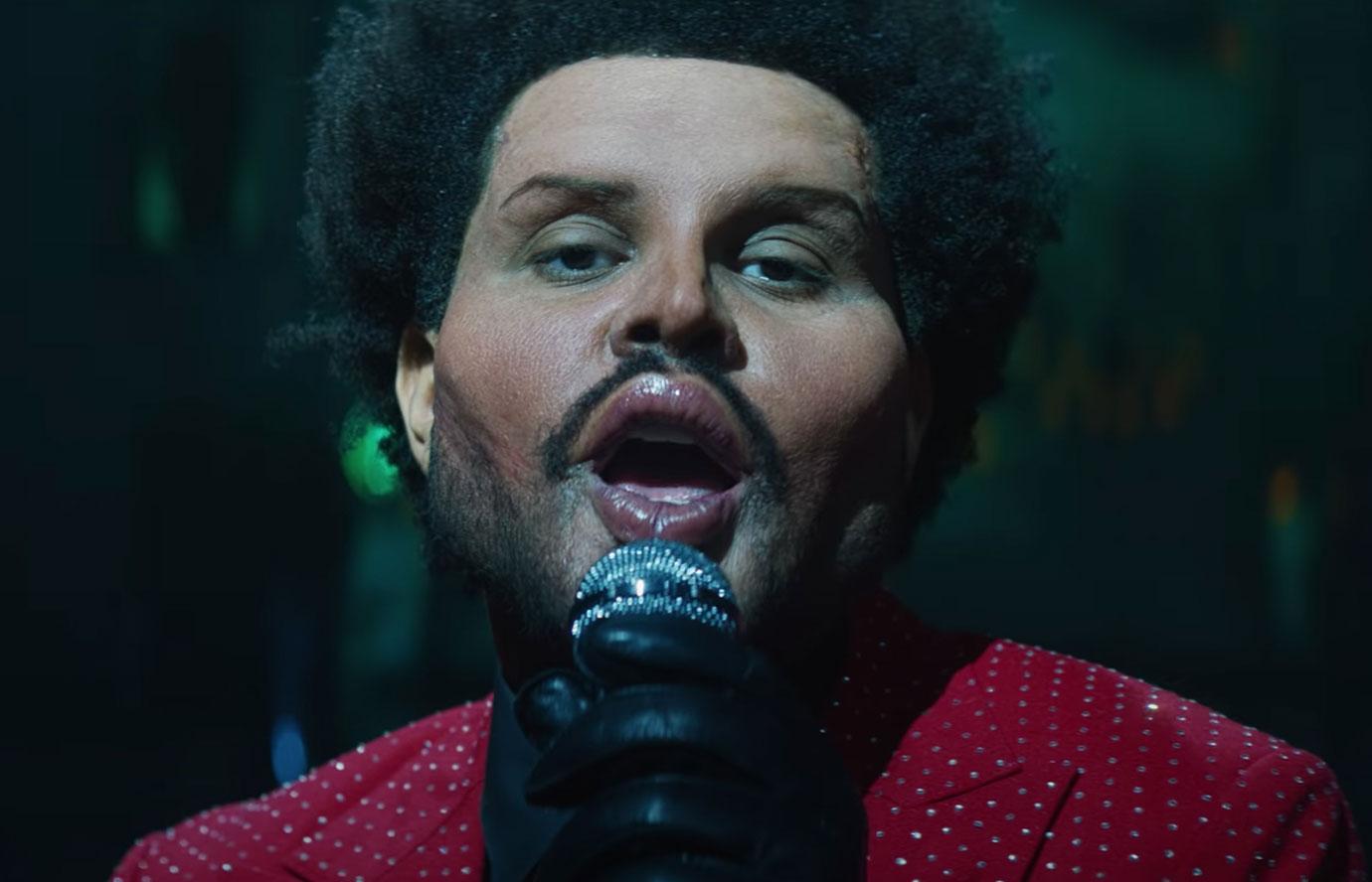 The Weeknd's Face Transformation: See Before And After Photos From His ...