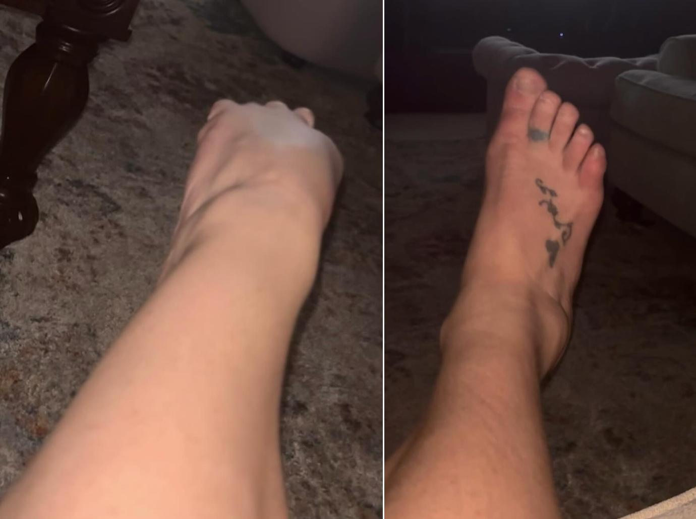 Britney Spears Thinks She Broke Her Foot Months After Twisting Ankle
