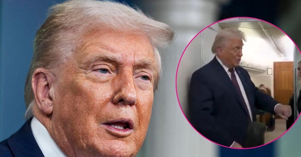 Donald Trump Addresses Bruise On Left Hand Amid Health Rumors