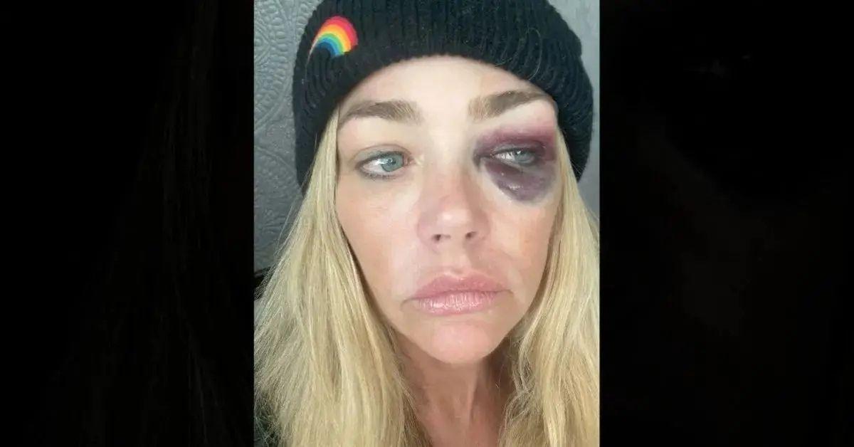 Denise Richards’ Ex Aaron Phypers Facing Prison Time After Abuse Arrest