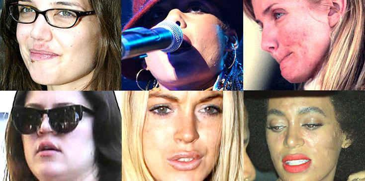 Dermatology Fail? Celebrity Skin Problems EXPOSED In 13 Clicks