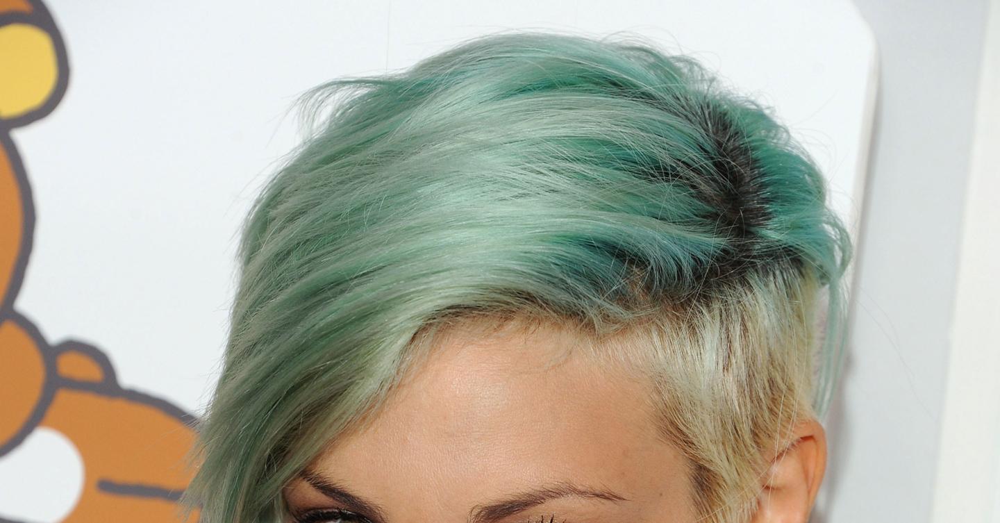 'ANTM' Winner Lisa D'Amato Injured in Freak Accident